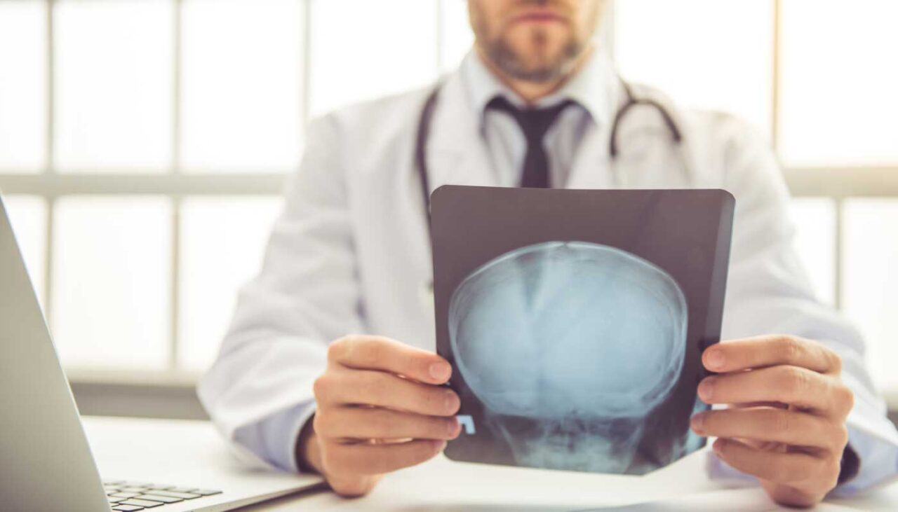 Onze hulp bij een verwaarloosde hersenschudding | Amsterdam Brain Center